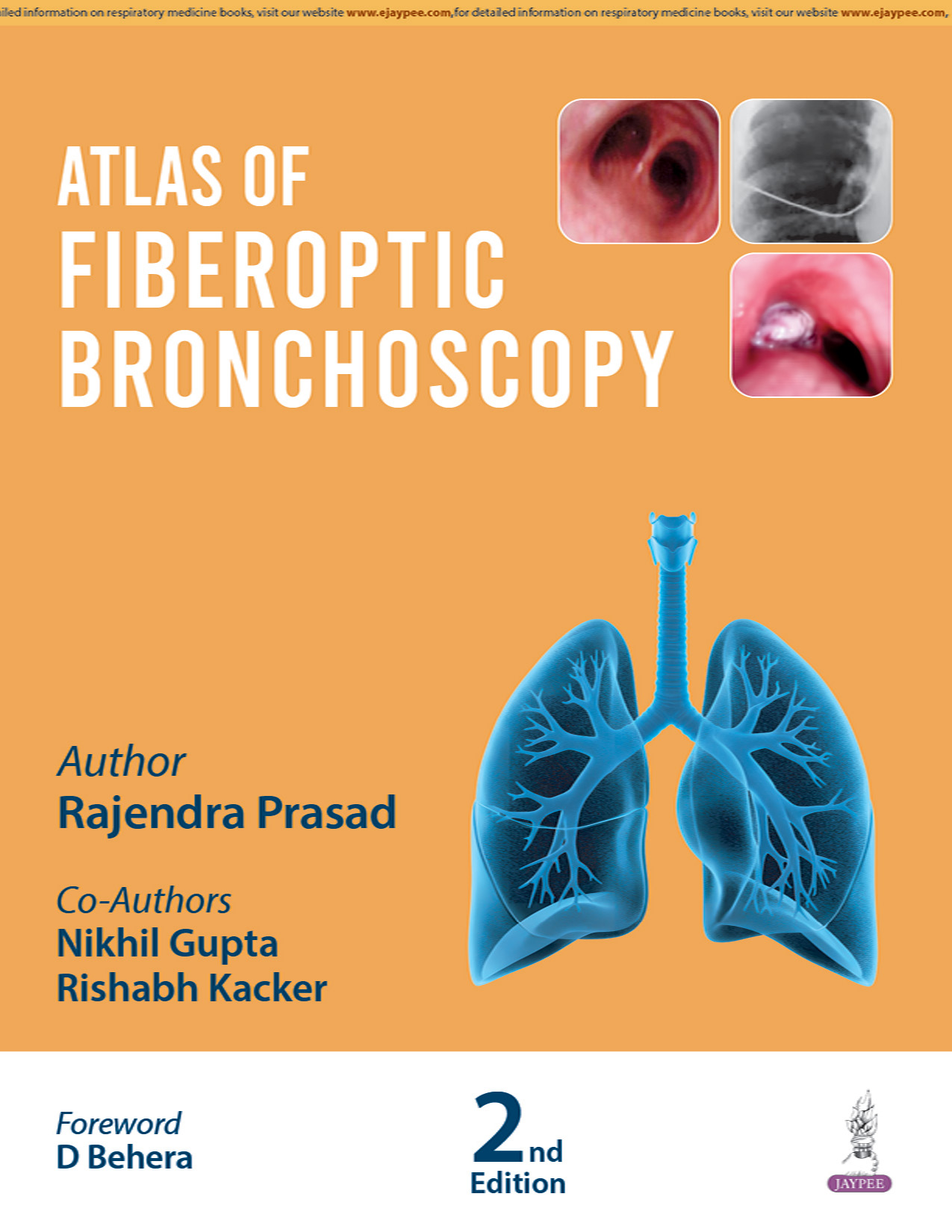 Bronchoscopy Anatomy